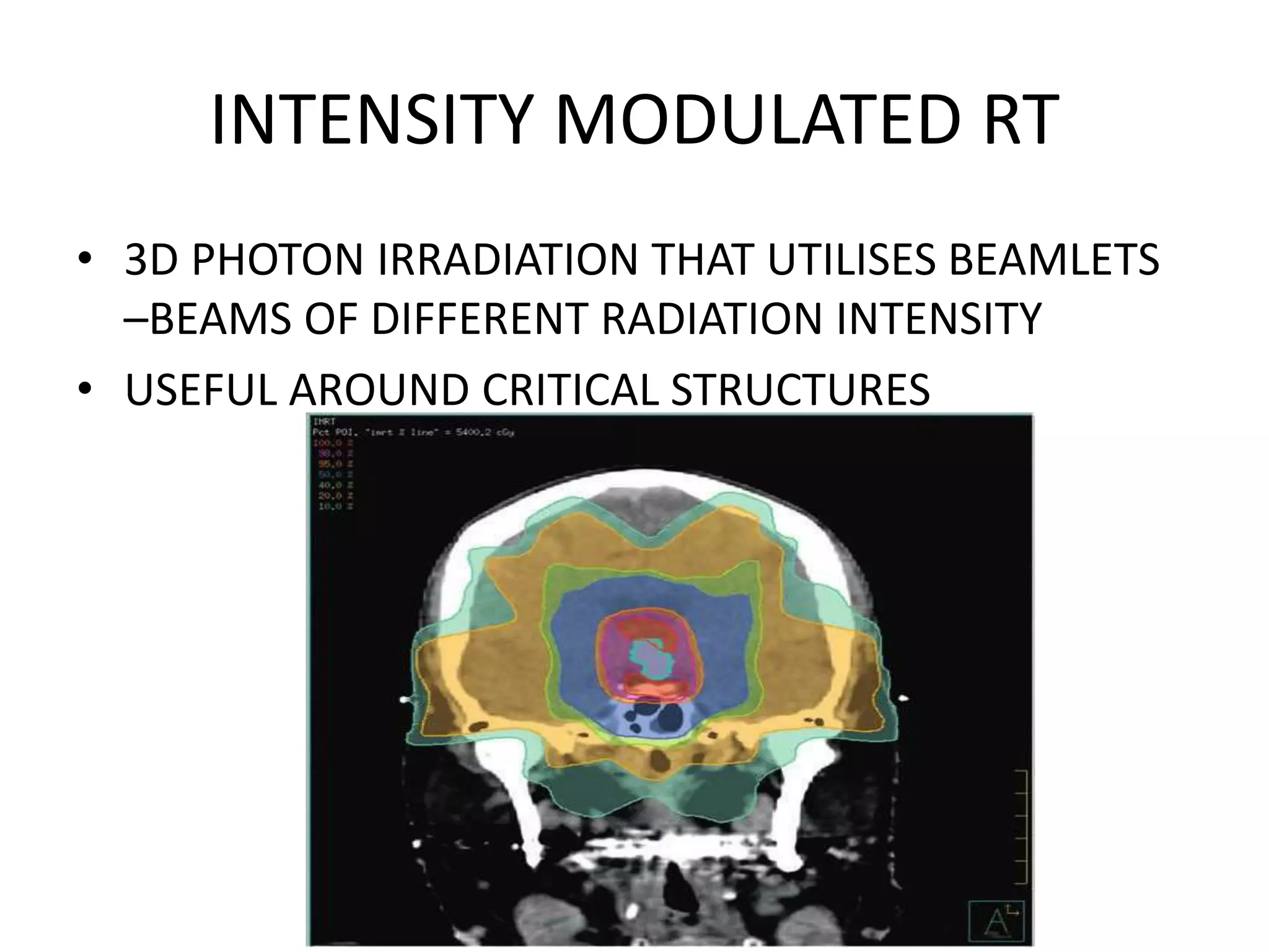Pediatric brain tumors | PPTX