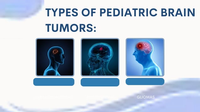 Pediatric Brain Tumors | PPTX