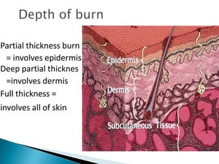 Pediatric burns | PPTX | First Aid | Injuries
