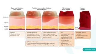 Comprehensive Guide to Pediatric Burns: Causes, Classification, and ...