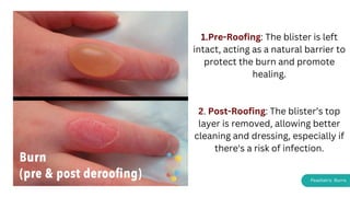 Comprehensive Guide to Pediatric Burns: Causes, Classification, and ...