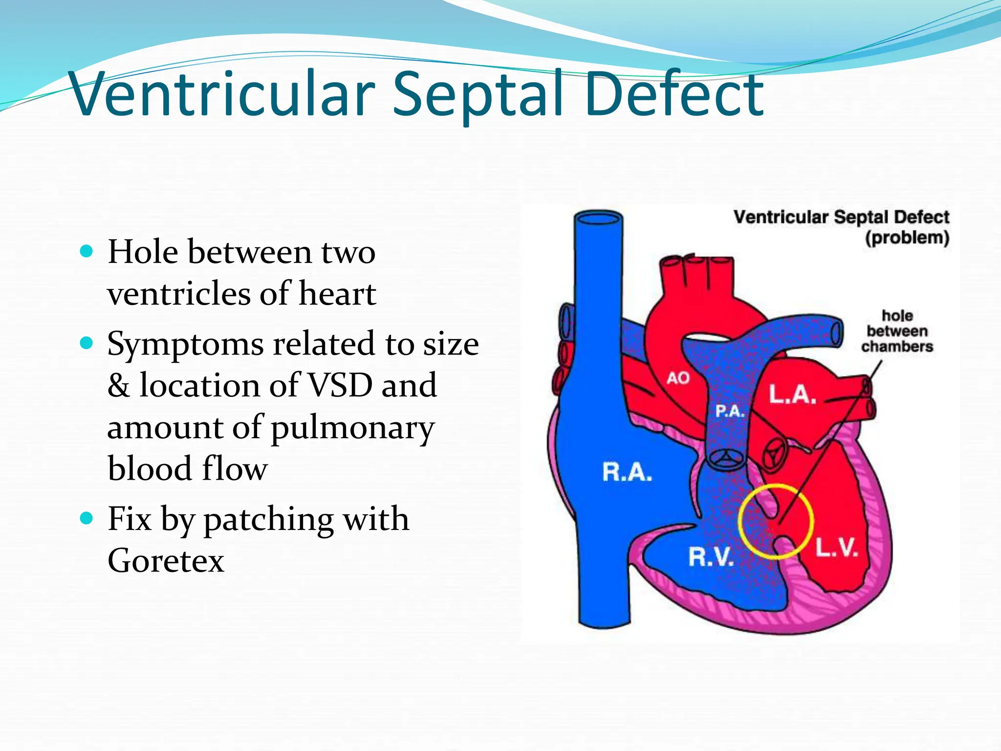 Pediatric_Cardiac_Disorders.ppt
