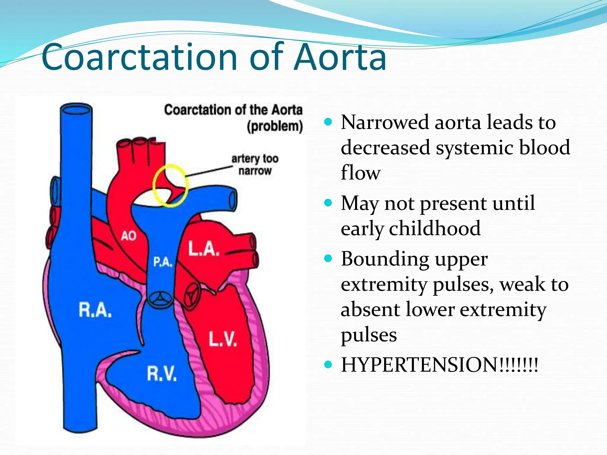 Pediatric_Cardiac_Disorders.ppt