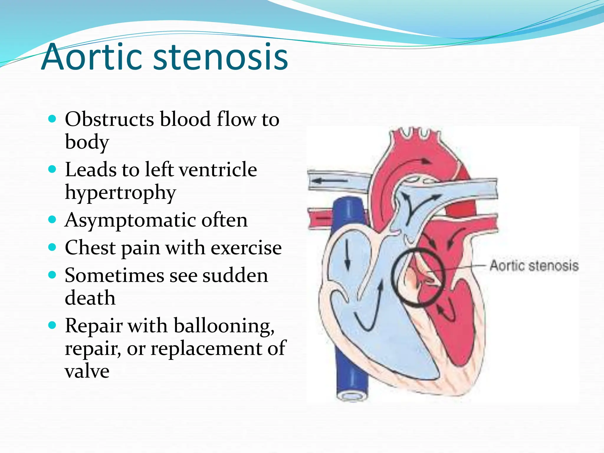 Pediatric_Cardiac_Disorders.ppt