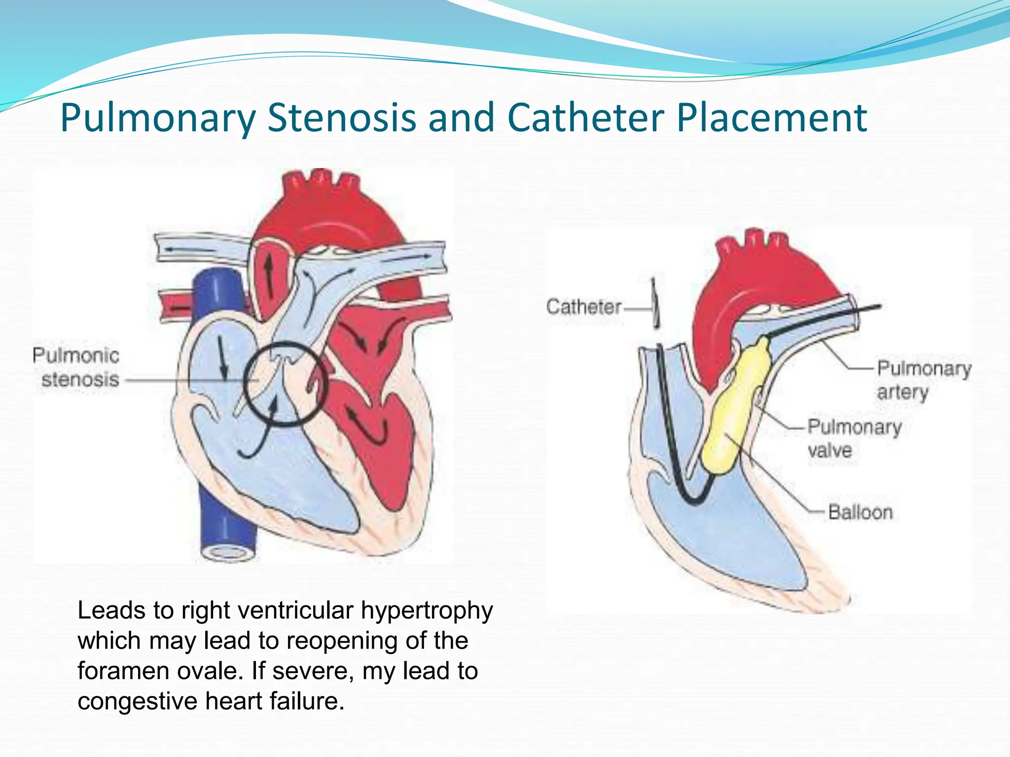 Pediatric_Cardiac_Disorders.ppt