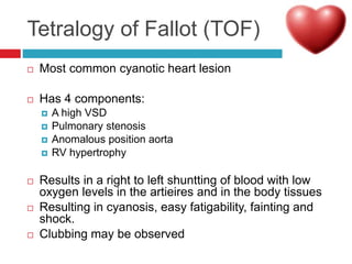 Common Cardiac disorders among Children.ppt