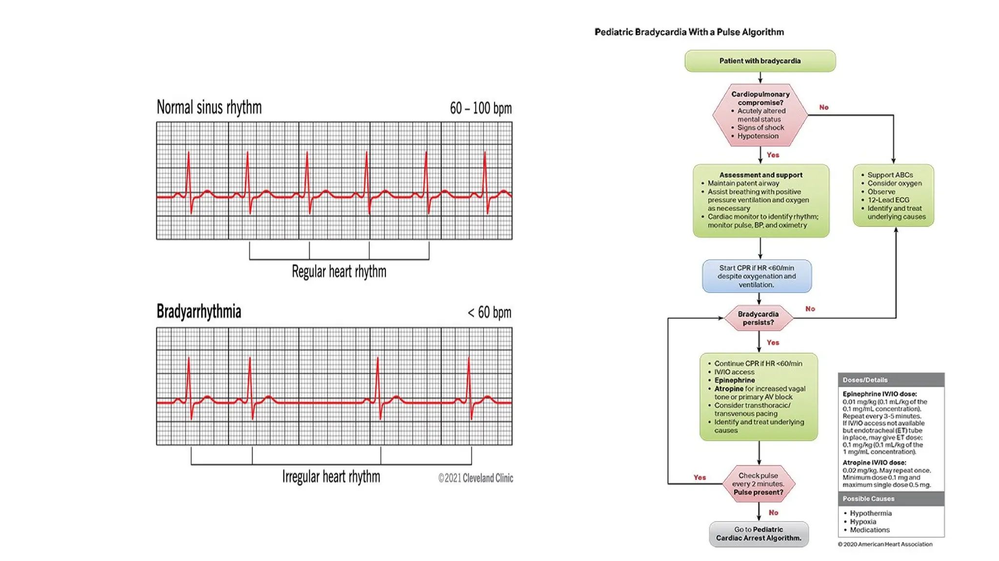 PEDIATRIC NURSING CARDIAC EMERGENCY AND ECG interpretation | PPT