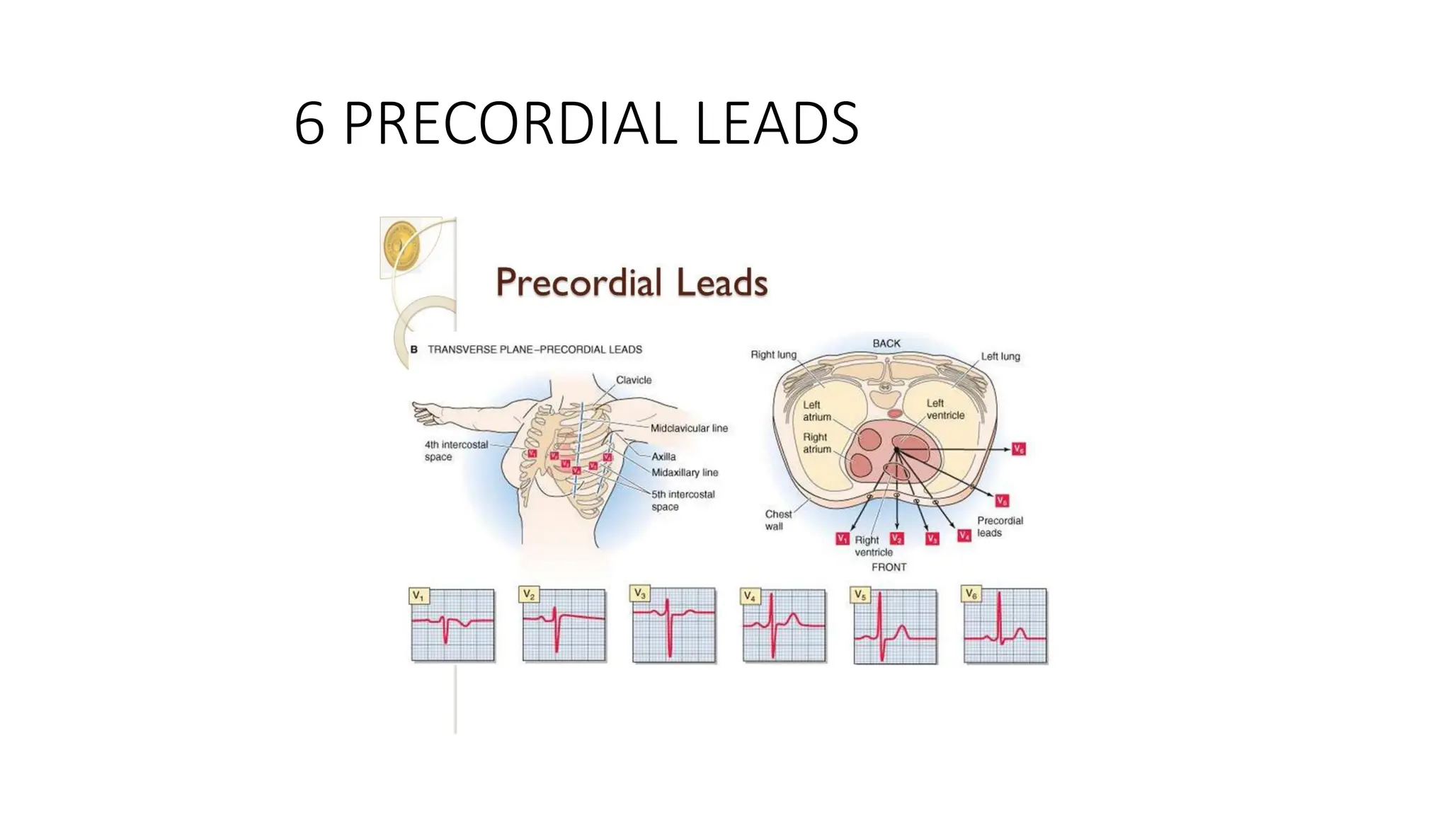 PEDIATRIC NURSING CARDIAC EMERGENCY AND ECG interpretation | PPTX