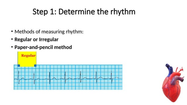 PEDIATRIC NURSING CARDIAC EMERGENCY AND ECG interpretation | PPT