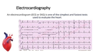 PEDIATRIC NURSING CARDIAC EMERGENCY AND ECG interpretation | PPTX