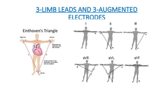 PEDIATRIC NURSING CARDIAC EMERGENCY AND ECG interpretation | PPTX