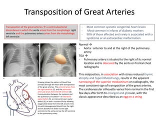 Pediatric Cardiology (1).pptx