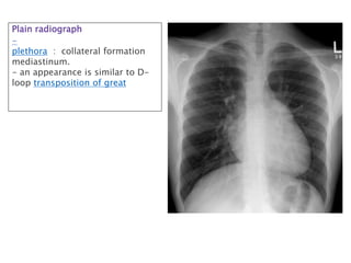 Pediatric Cardiology (1).pptx