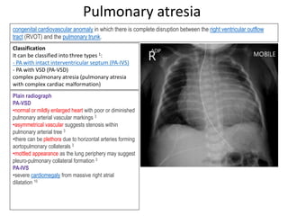 Pediatric Cardiology (1).pptx