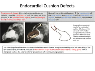 Pediatric Cardiology (1).pptx