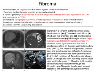 Pediatric Cardiology (1).pptx