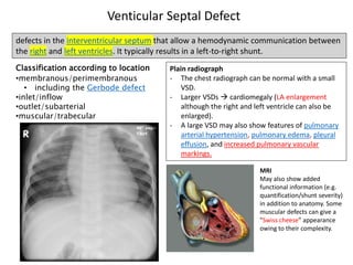 Pediatric Cardiology (1).pptx