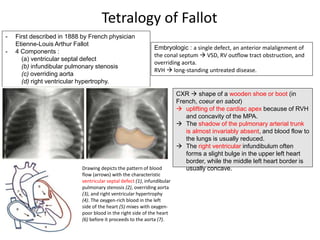 Pediatric Cardiology (1).pptx