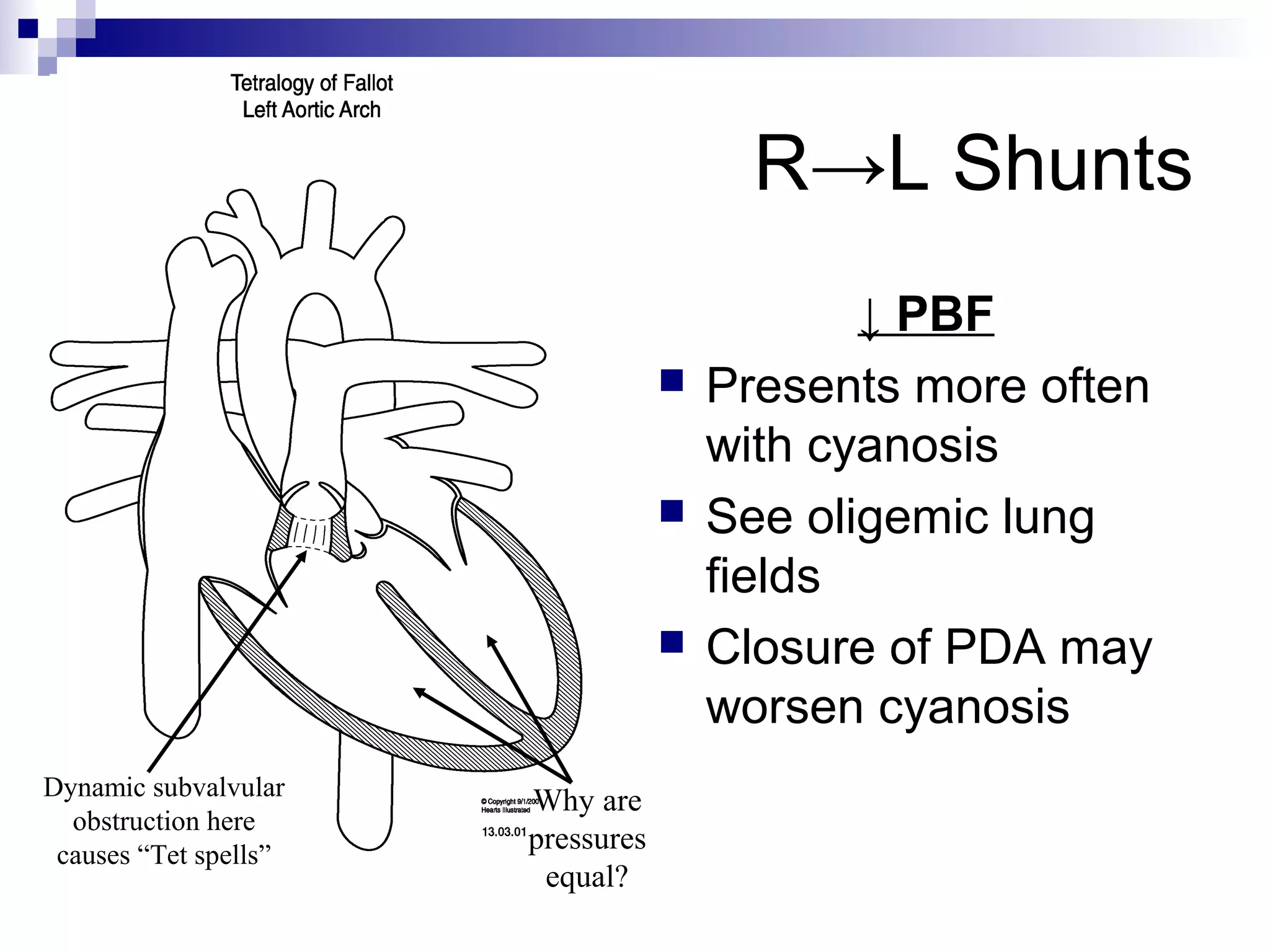 Pediatric-Cardiology-101.ppt