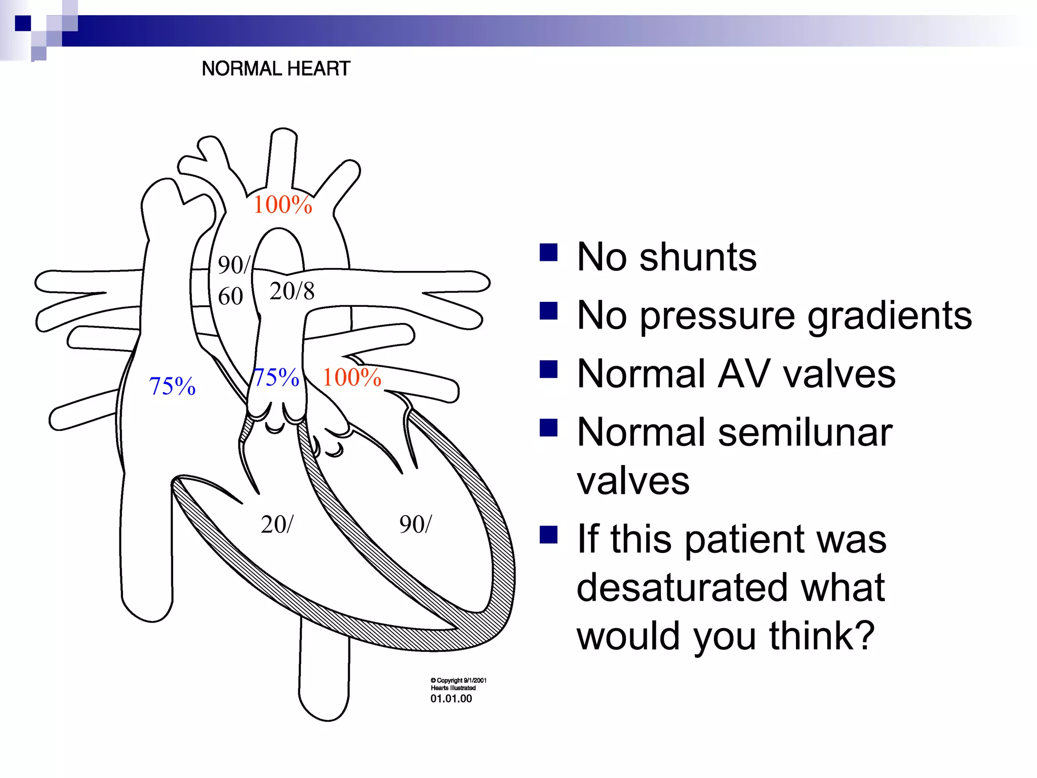 Pediatric-Cardiology-101.ppt