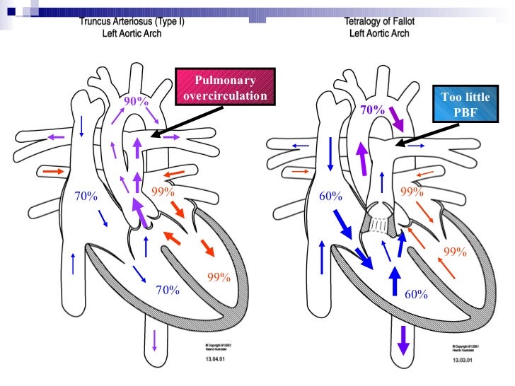 Pediatric-Cardiology-101.ppt