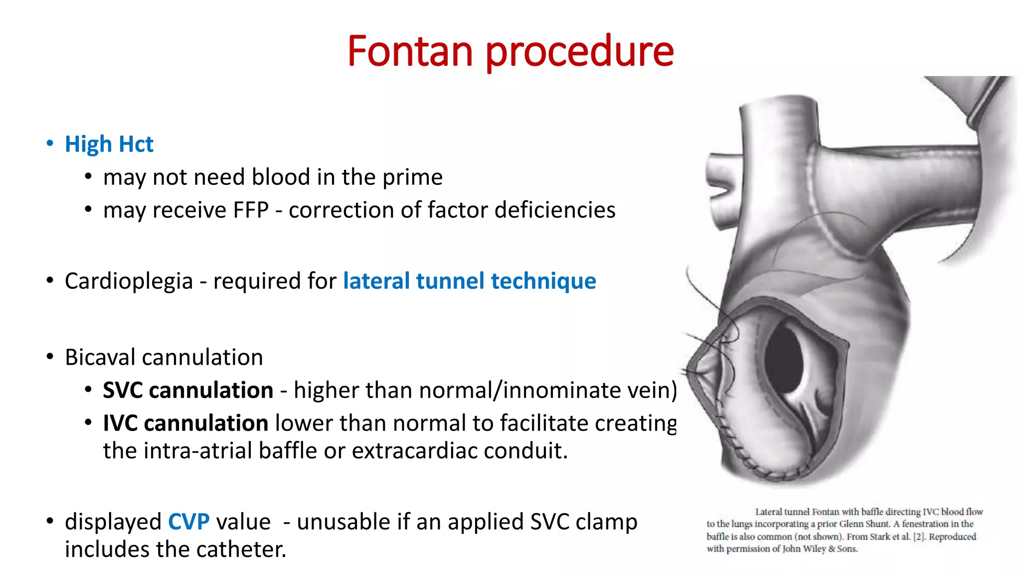 Pediatric cardiopulmonary bypass | PPTX