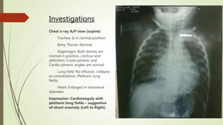 Pediatric case presentation (congenital heart disease- PDA) | PPTX