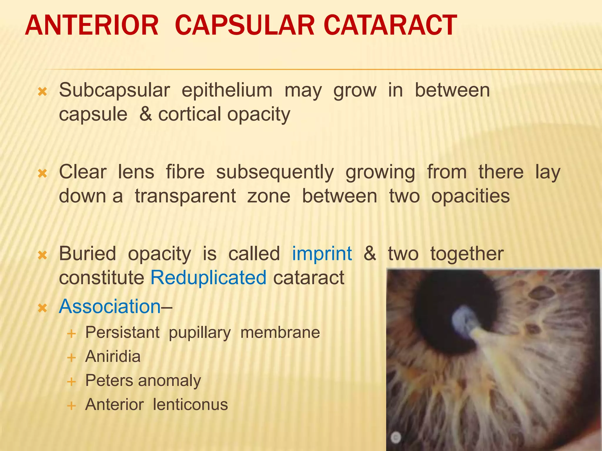 Pediatric cataract | PPTX