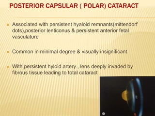 Pediatric cataract | PPTX