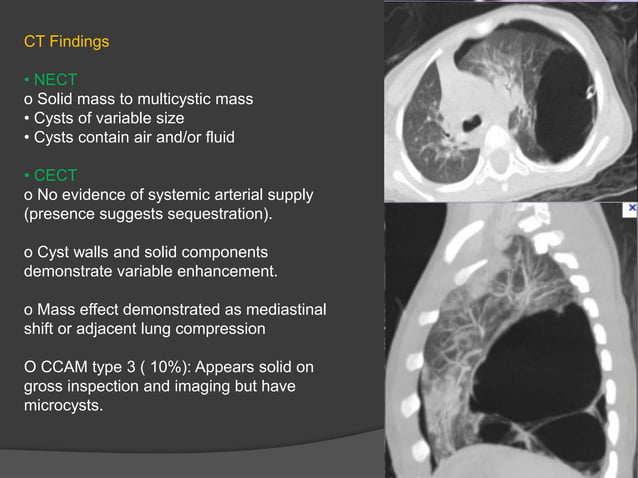 Pediatric chest | PPTX | Lung and Respiratory Health | Diseases and ...