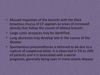 Pediatric chest infection imaging considerations | PPTX