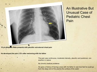 Pediatric chest pain | PPTX