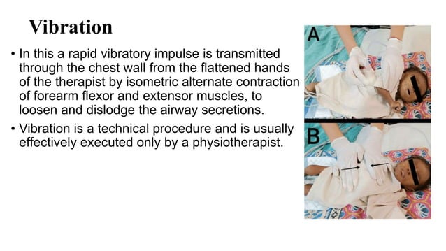 Pediatric chest physiotherapy.pptx