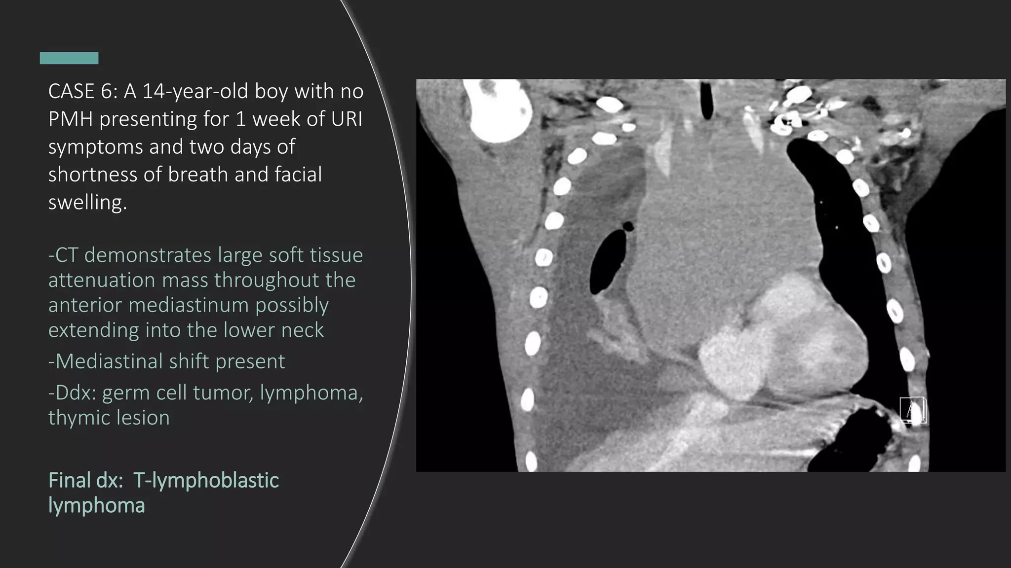 CMC Pediatric X-Ray Mastery: October Cases | PPTX