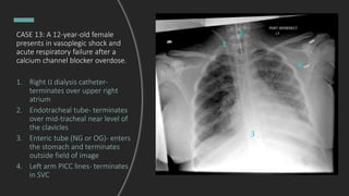 CMC Pediatric X-Ray Mastery: October Cases | PPT