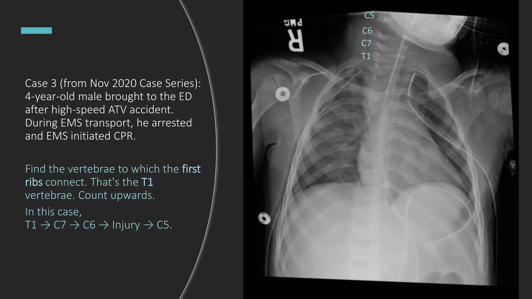 CMC Pediatric X-Ray Mastery: February Case | PPTX