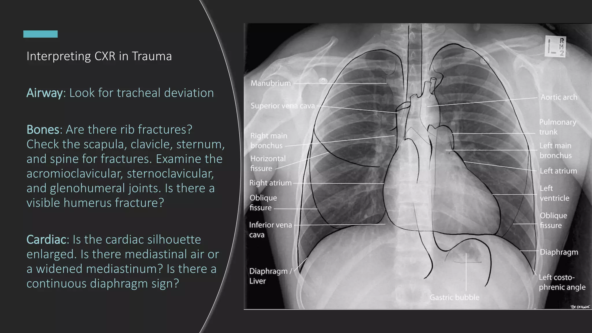 CMC Pediatric X-Ray Mastery: February Case | PPTX
