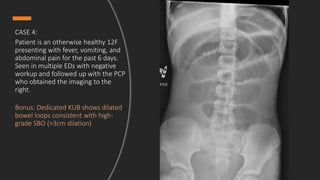Drs. Olson’s and Jackson’s CMC Pediatric X-Ray Mastery: August Cases | PPT