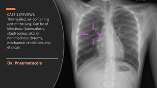 Drs. Olson’s and Jackson’s CMC Pediatric X-Ray Mastery: August Cases | PPTX