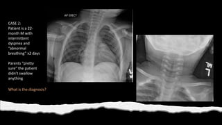 Drs. Olson’s and Jackson’s CMC Pediatric X-Ray Mastery: August Cases | PPT