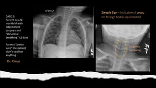 Drs. Olson’s and Jackson’s CMC Pediatric X-Ray Mastery: August Cases | PPT