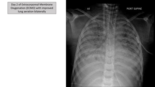 Drs. Potter and Richardson's CMC Pediatric X-Ray Mastery August Cases | PPT