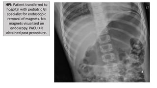Drs. Potter and Richardson's CMC Pediatric X-Ray Mastery January Cases ...