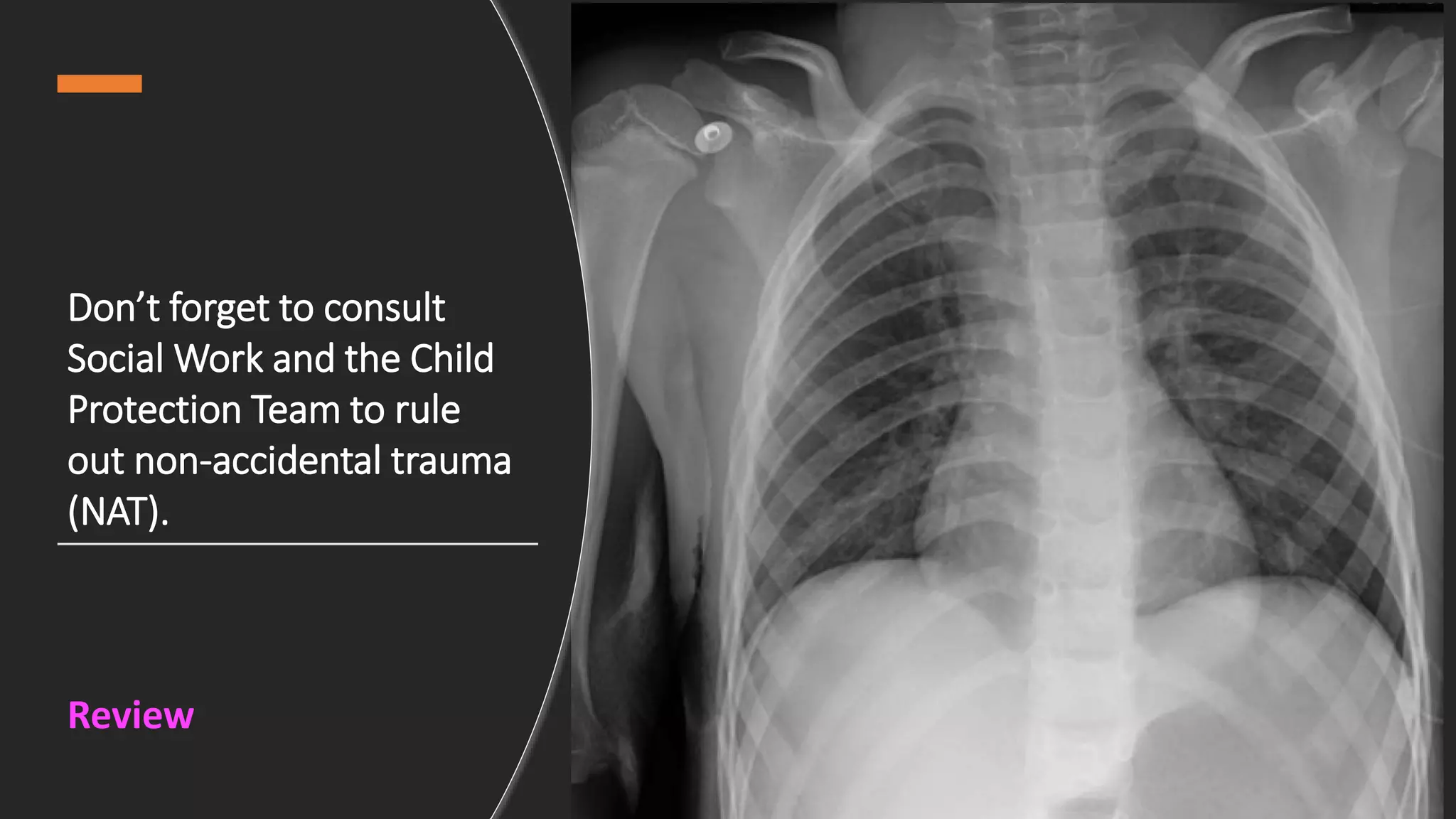Drs. Olson’s and Jackson’s CMC Pediatric X-Ray Mastery: May Cases | PPT
