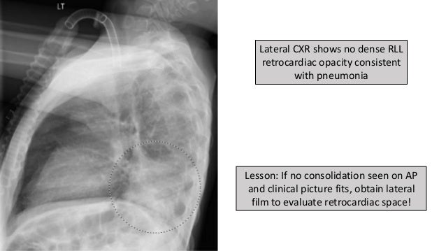 Drs. Potter and Richardson's CMC Pediatric X-Ray Mastery October Cases