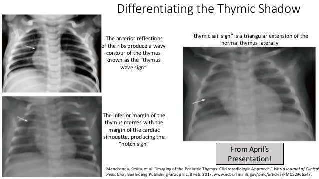 Drs. Potter and Richardson's CMC Pediatric X-Ray Mastery October Cases