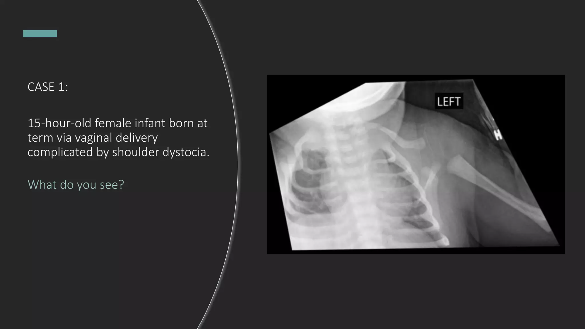 CMC Pediatric X-Ray Mastery: 27th Case Series | PPTX