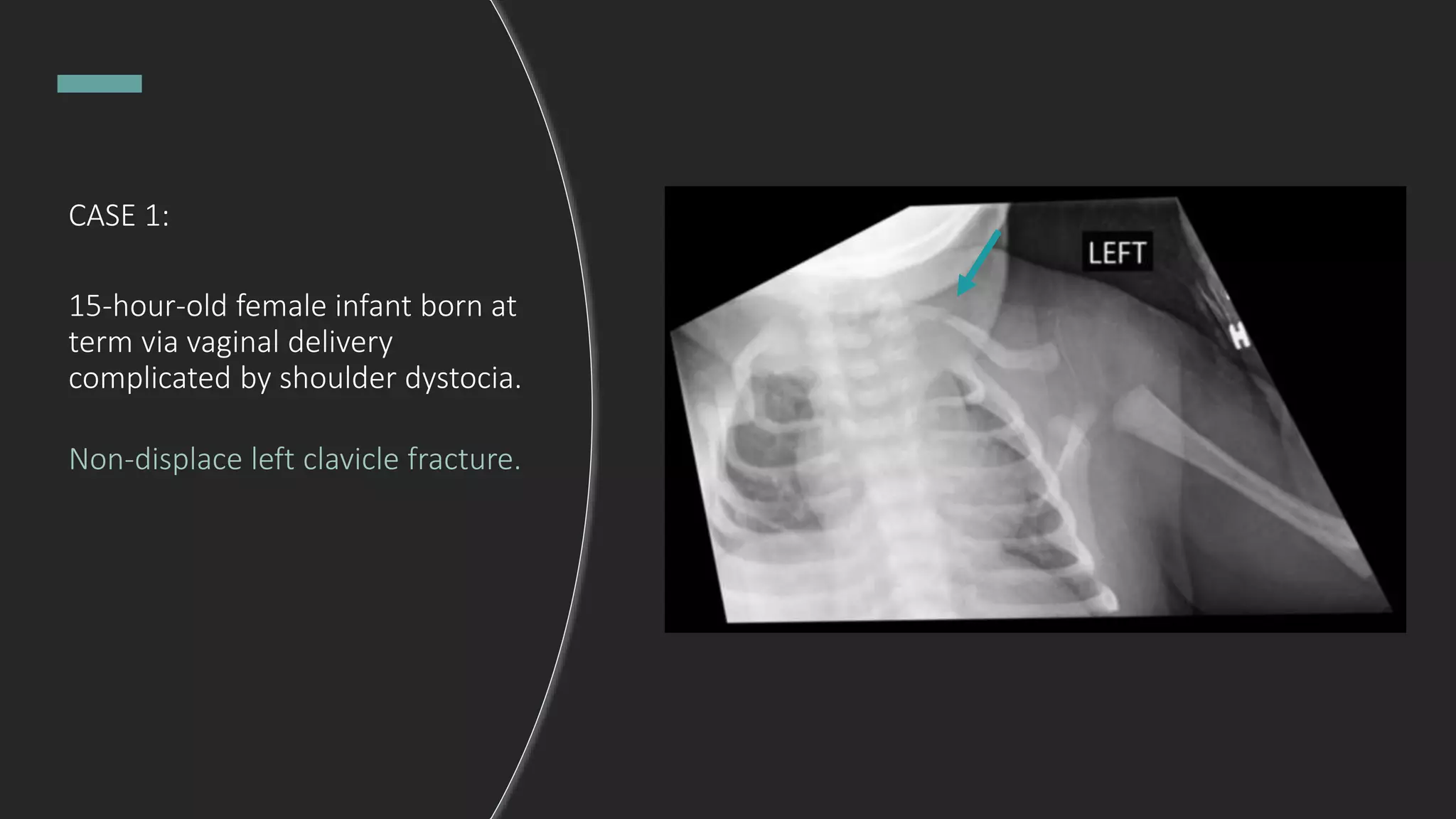 CMC Pediatric X-Ray Mastery: 27th Case Series | PPTX