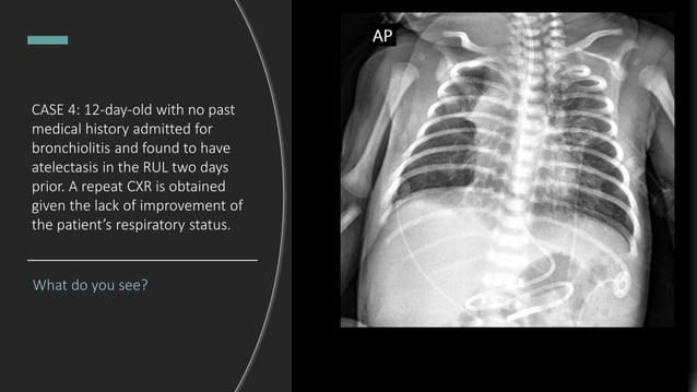 CMC Pediatric X-Ray Mastery: 27th Case Series | PPT