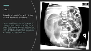 CMC Pediatric X-Ray Mastery: 27th Case Series | PPTX | Pregnancy ...